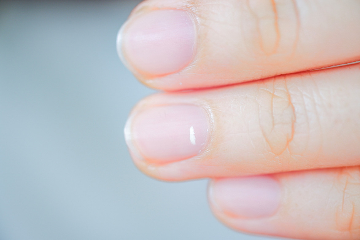 Wat zijn die witte vlekjes op je nagels? - Beautyspecialisten in vlaanderen